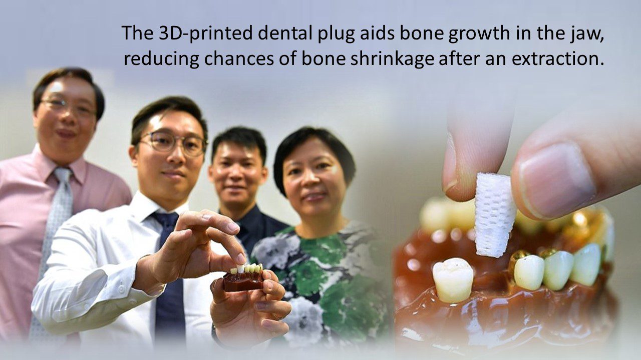 NAMIC - 3D-PRINTED DENTAL PLUGS COULD BE BOON FOR PATIENTS