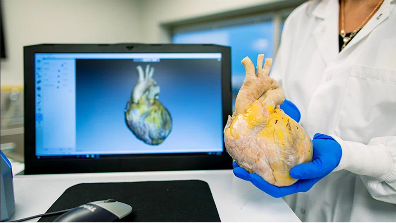 NAMIC - 3D Printed Medical Models Enables Personalisation of Patient Care