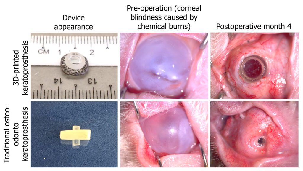 Restoring Sight with Science: How 3D Printing Could Transform Corneal ...